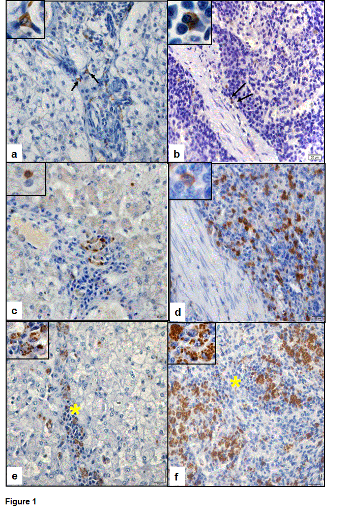 CD56 and CD3 expression in the liver and spleen of dogs with visceral ...