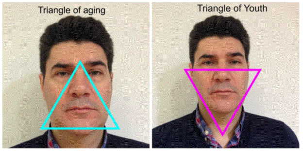 Hybrid Lifting Homologous Therapy® (HLH THERAPY ®) A New Step in ...