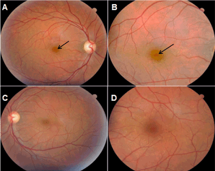 [TEMPLATE] Artificial Intelligence Image Analysis Service to Detect ...