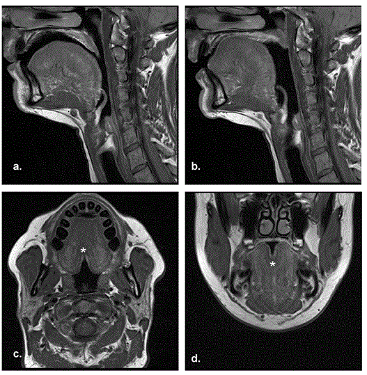 Vocal tract configuration for breathing and speech sound production