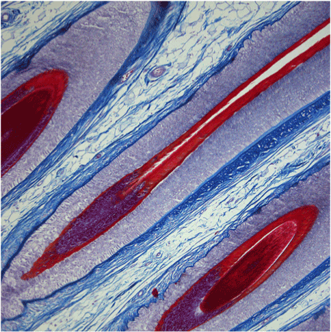 Histological POP ART - A journey through the skin