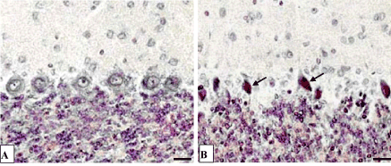 Purkinje Cells Histology