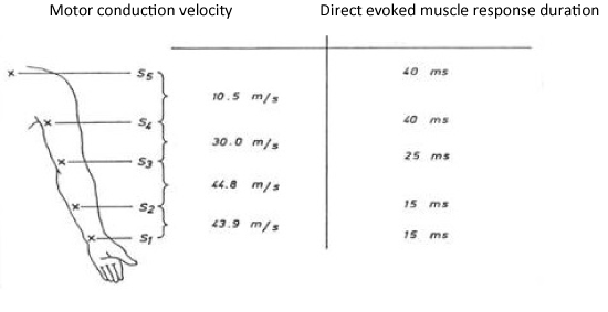 Why electromyoneurography instead of electromyography and ...